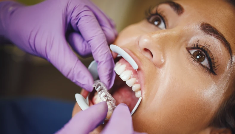 How Long Does Invisalign Hurt?